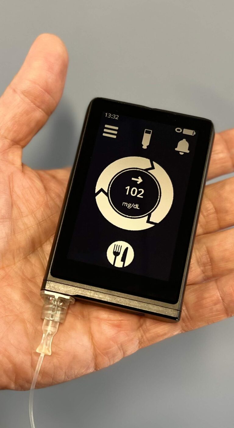 CHOC trial shows bionic pancreas improves type 1 diabetes management ...